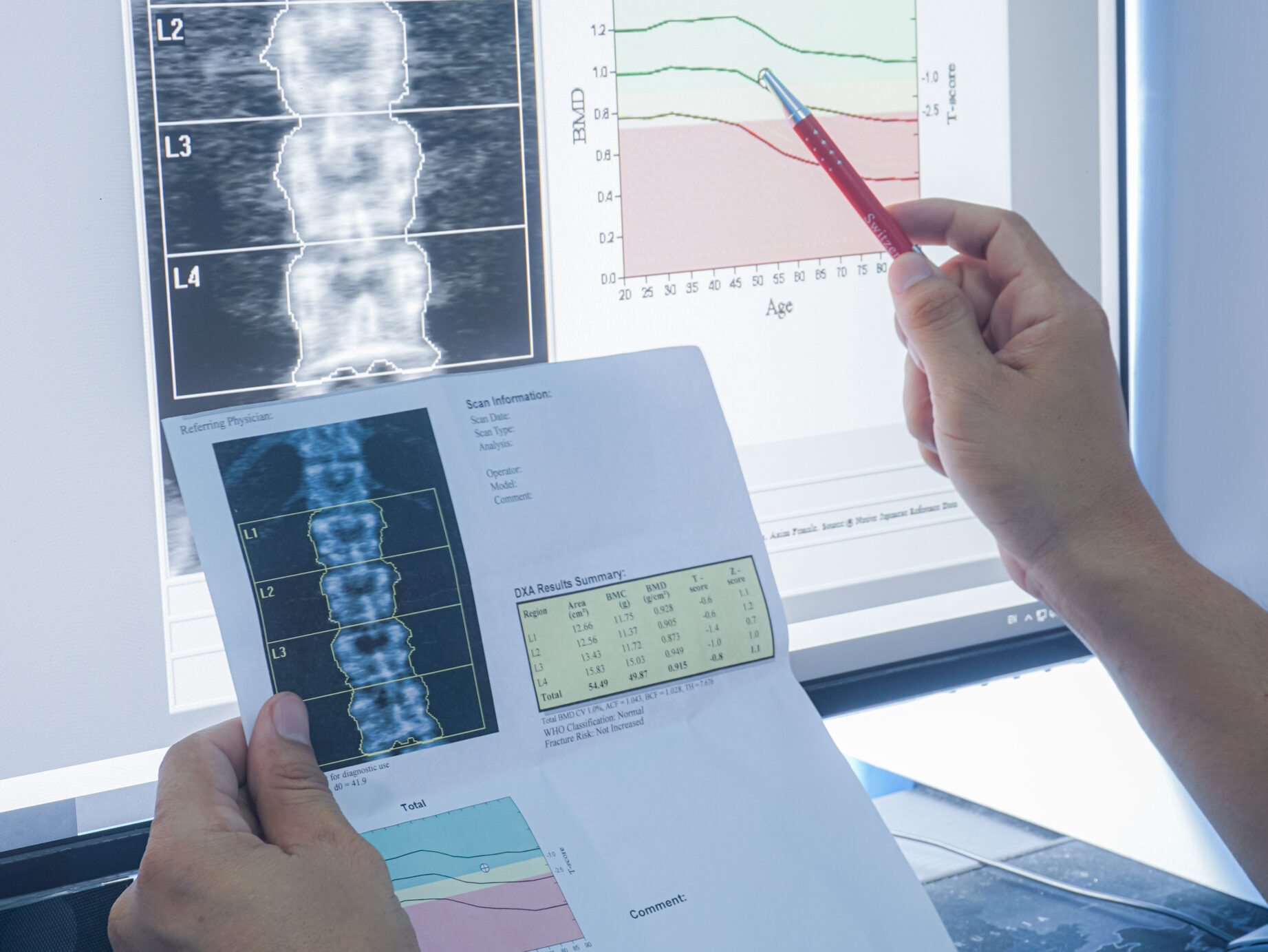 BMD Scan – Coastal Medical Imaging